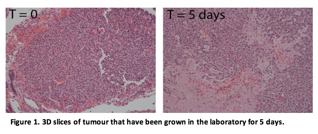 Translational Cancer Research Program - Research Project - Harry ...