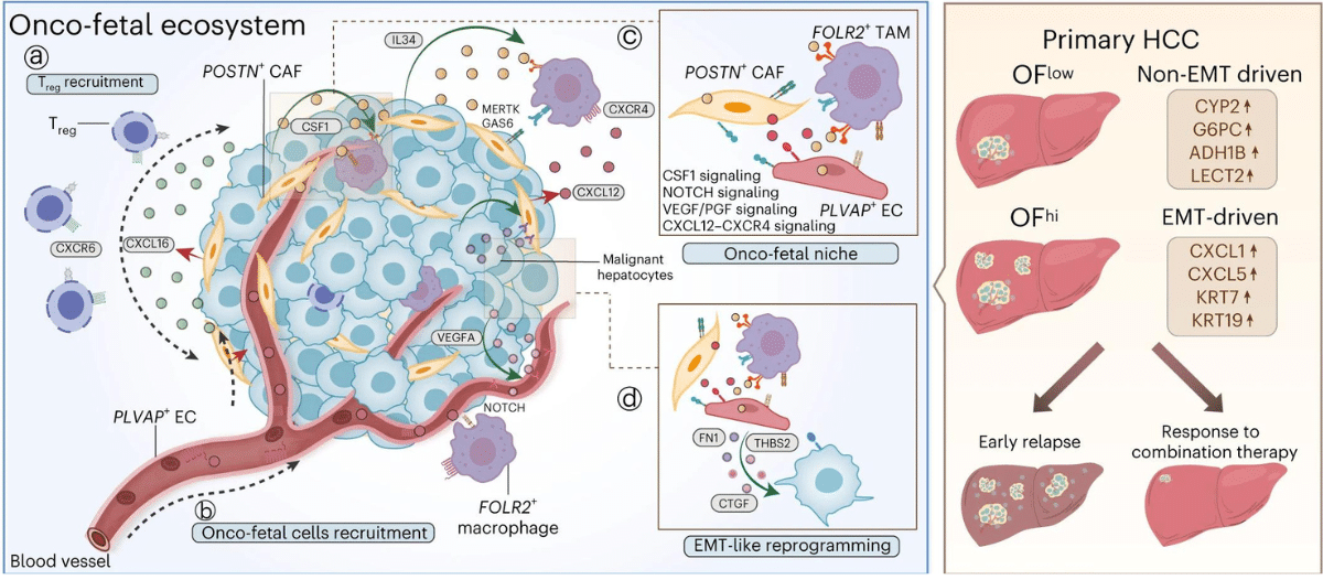 New biomarker predicts liver cancer recurrence and immunotherapy ...